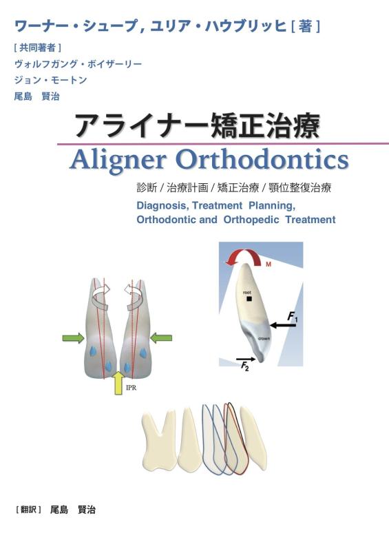 アライナー矯正治療 　 診断/治療計画/矯正治療/顎位整復治療