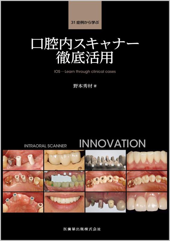 31症例から学ぶ口腔内スキャナー徹底活用■ ご購入前に必ずご確認ください ■1. 在庫管理とご注文の確定当店は複数のオンラインモールで在庫を共有しております。在庫の変動： 更新のタイムラグにより、ご注文後に「完売」が判明する場合がございます...