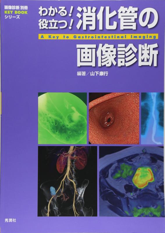 わかる 役立つ 消化管の画像診断 (画像診断別冊 KEYBOOK)