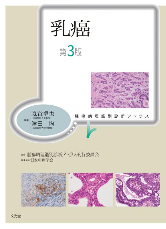 乳癌　第3版(腫瘍病理鑑別診断アトラス)■ ご購入前に必ずご確認ください ■1. 在庫管理とご注文の確定当店は複数のオンラインモールで在庫を共有しております。在庫の変動： 更新のタイムラグにより、ご注文後に「完売」が判明する場合がございます...