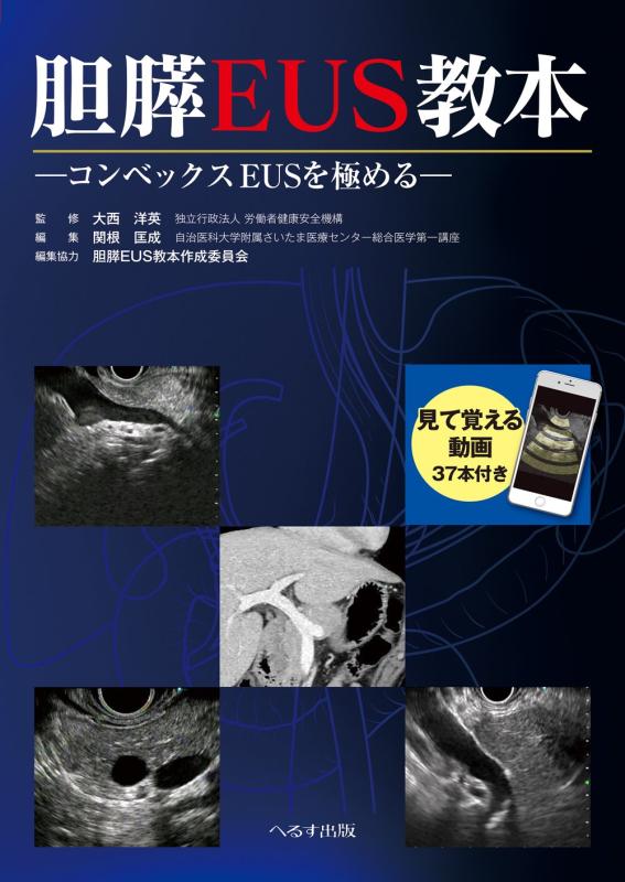胆膵EUS教本: コンベックスEUSを極める■ ご購入前に必ずご確認ください ■1. 在庫管理とご注文の確定当店は複数のオンラインモールで在庫を共有しております。在庫の変動： 更新のタイムラグにより、ご注文後に「完売」が判明する場合がござい...