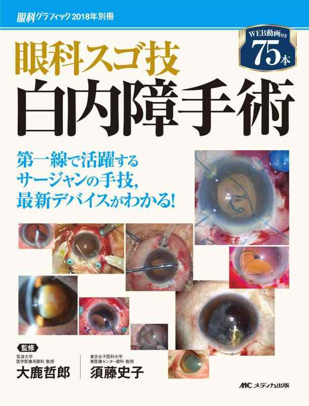 眼科スゴ技 白内障手術: WEB動画付き 75本 第一線で活躍するサージャンの手技、最新デバイスがわかる (眼科グラフィック2018年別冊)■ ご購入前に必ずご確認ください ■1. 在庫管理とご注文の確定当店は複数のオンラインモールで在庫を...