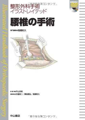 腰椎の手術 (整形外科手術イラストレイテッド(DVD付）)■ ご購入前に必ずご確認ください ■1. 在庫管理とご注文の確定当店は複数のオンラインモールで在庫を共有しております。在庫の変動： 更新のタイムラグにより、ご注文後に「完売」が判明す...
