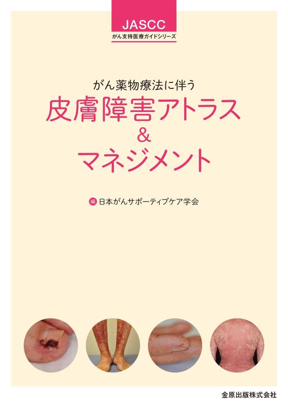 がん薬物療法に伴う皮膚障害アトラス&amp;マネジメント (JASCCがん支持医療ガイドシリーズ)■ ご購入前に必ずご確認ください ■1. 在庫管理とご注文の確定当店は複数のオンラインモールで在庫を共有しております。在庫の変動： 更新のタイ...