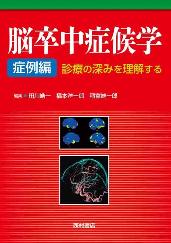 脳卒中症候学 症例編: 診療の深みを理解する■ ご購入前に必ずご確認ください ■1. 在庫管理とご注文の確定当店は複数のオンラインモールで在庫を共有しております。在庫の変動： 更新のタイムラグにより、ご注文後に「完売」が判明する場合がござい...