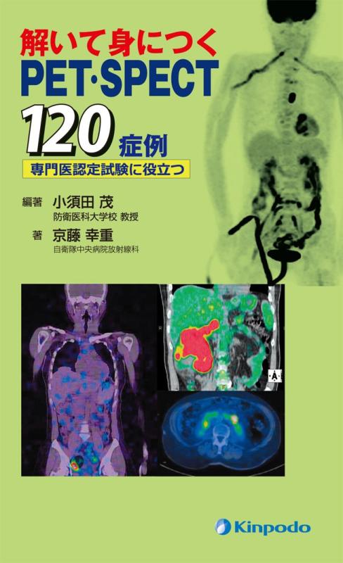 解いて身につくPET・SPECT120症例: 専門医認定試験に役立つ■ ご購入前に必ずご確認ください ■1. 在庫管理とご注文の確定当店は複数のオンラインモールで在庫を共有しております。在庫の変動： 更新のタイムラグにより、ご注文後に「完売...