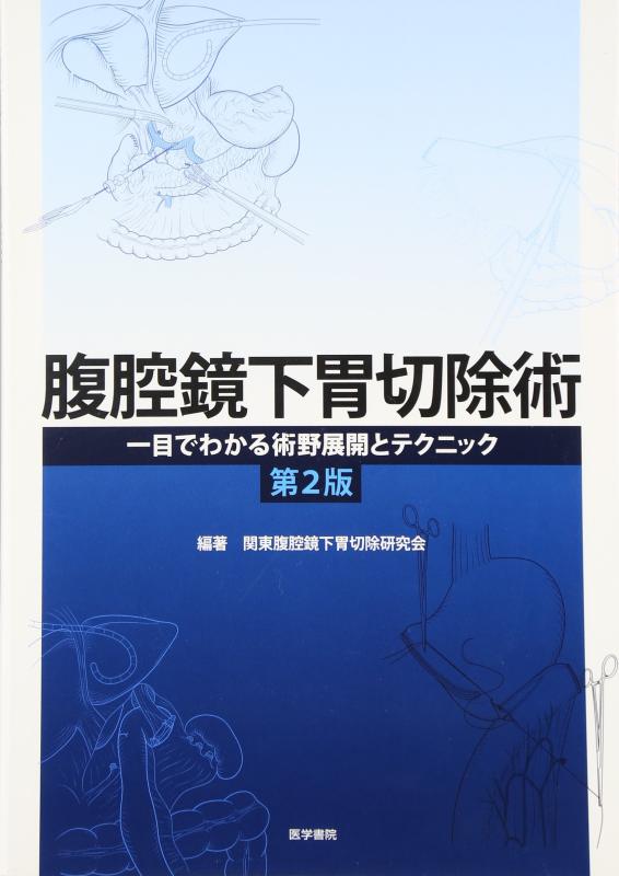 腹腔鏡下胃切除術: 一目でわかる術野展開とテクニック