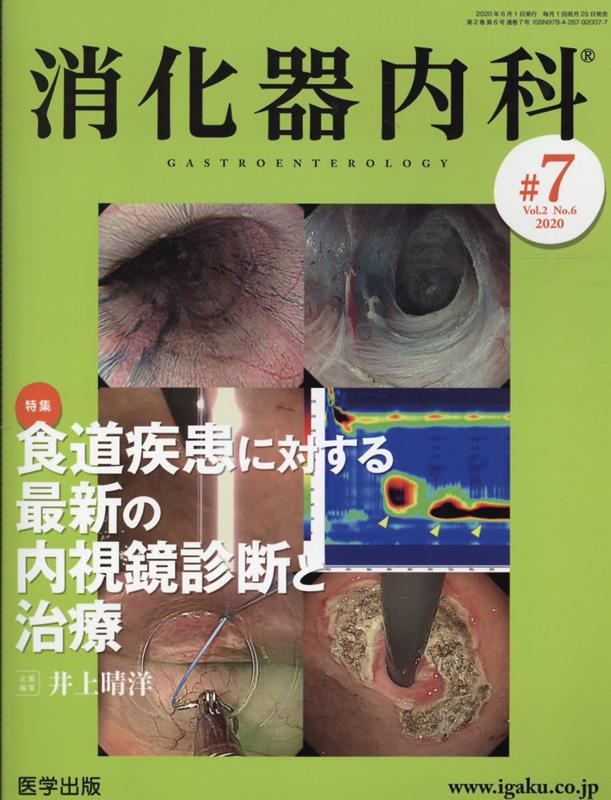 ◆◆◆おおむね良好な状態です。中古商品のため使用感等ある場合がございますが、品質には十分注意して発送いたします。 【毎日発送】 商品状態 著者名 編集:井上 晴洋 出版社名 医学出版 発売日 2020年06月01日 ISBN 9784287...