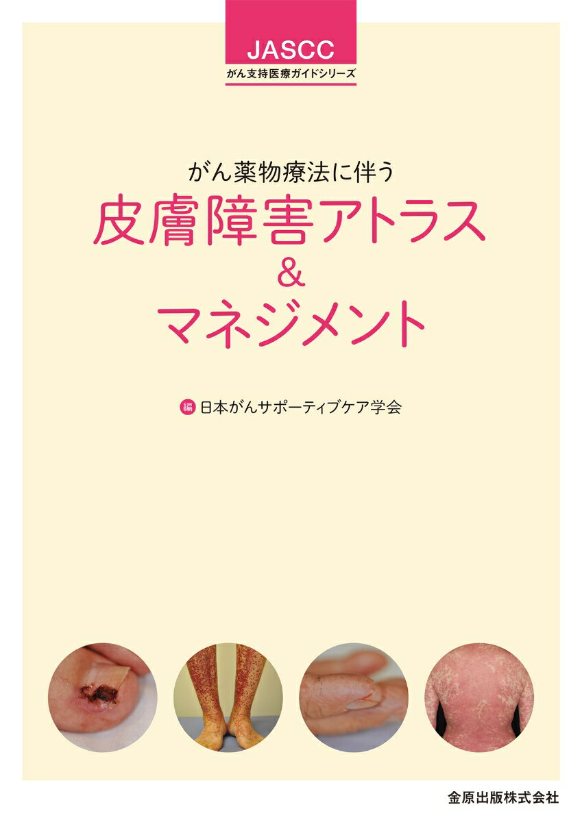 ◆◆◆非常にきれいな状態です。中古商品のため使用感等ある場合がございますが、品質には十分注意して発送いたします。 【毎日発送】 商品状態 著者名 日本がんサポーティブケア学会 出版社名 金原出版 発売日 2018年08月31日 ISBN 9...