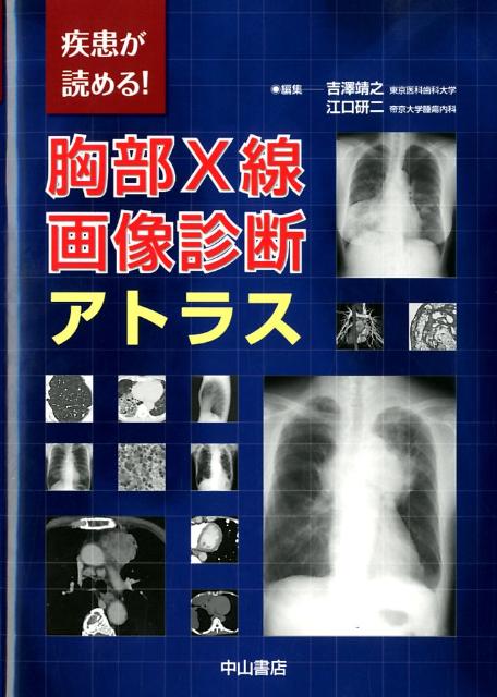 ◆◆◆おおむね良好な状態です。中古商品のため使用感等ある場合がございますが、品質には十分注意して発送いたします。 【毎日発送】 商品状態 著者名 吉沢靖之、江口研二 出版社名 中山書店 発売日 2012年8月1日 ISBN 97845217...