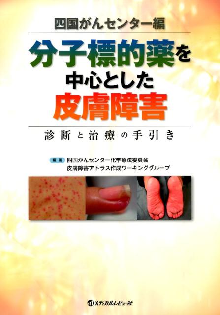 ◆◆◆小口に汚れがあります。中古ですので多少の使用感がありますが、品質には十分に注意して販売しております。迅速・丁寧な発送を心がけております。【毎日発送】 商品状態 著者名 国立病院機構四国がんセンタ− 出版社名 メディカルレビュ−社 発売...