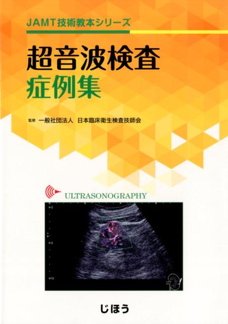 ◆◆◆カバーに日焼けがあります。中古ですので多少の使用感がありますが、品質には十分に注意して販売しております。迅速・丁寧な発送を心がけております。【毎日発送】 商品状態 著者名 日本臨床衛生検査技師会 出版社名 じほう 発売日 2016年8...
