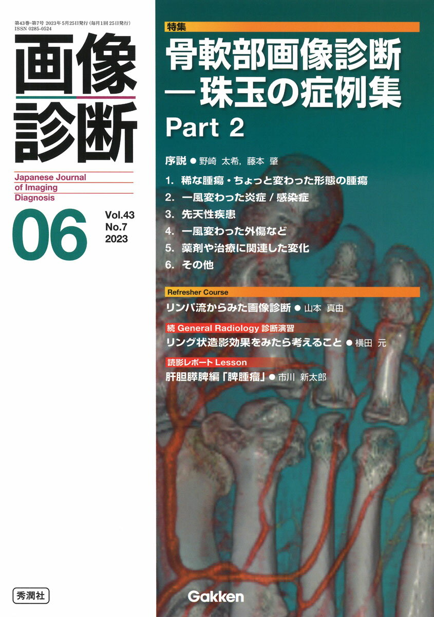 ◆◆◆非常にきれいな状態です。中古商品のため使用感等ある場合がございますが、品質には十分注意して発送いたします。 【毎日発送】 商品状態 著者名 画像診断実行編集委員会、野崎太希、藤本肇 出版社名 Gakken 発売日 2023年05月25...