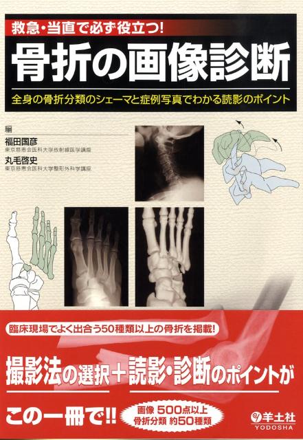 ◆◆◆おおむね良好な状態です。中古商品のため使用感等ある場合がございますが、品質には十分注意して発送いたします。 【毎日発送】 商品状態 著者名 福田国彦、丸毛啓史 出版社名 羊土社 発売日 2008年12月11日 ISBN 9784758...