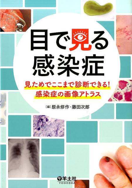◆◆◆非常にきれいな状態です。中古商品のため使用感等ある場合がございますが、品質には十分注意して発送いたします。 【毎日発送】 商品状態 著者名 原永修作、藤田次郎 出版社名 羊土社 発売日 2015年06月17日 ISBN 9784758...