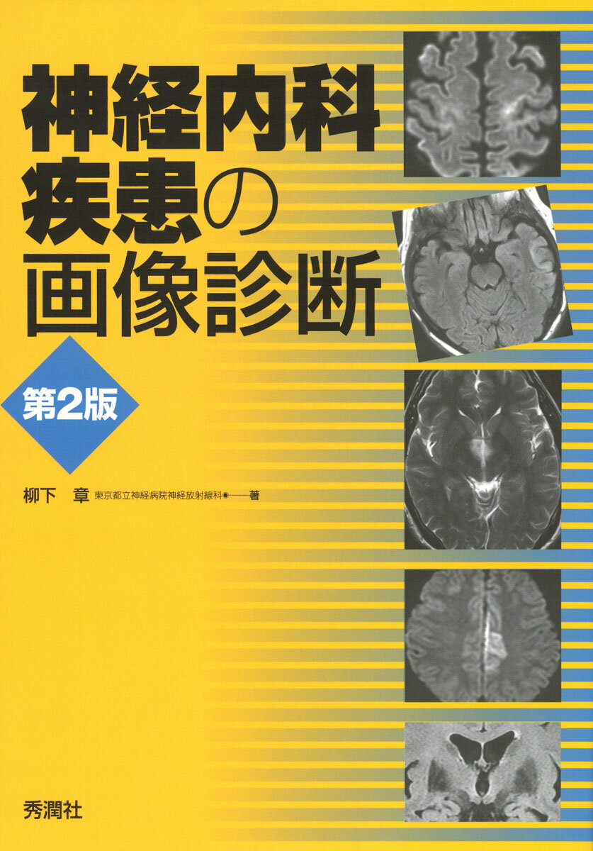 ◆◆◆非常にきれいな状態です。中古商品のため使用感等ある場合がございますが、品質には十分注意して発送いたします。 【毎日発送】 商品状態 著者名 柳下章 出版社名 学研メディカル秀潤社 発売日 2019年04月15日 ISBN 978478...
