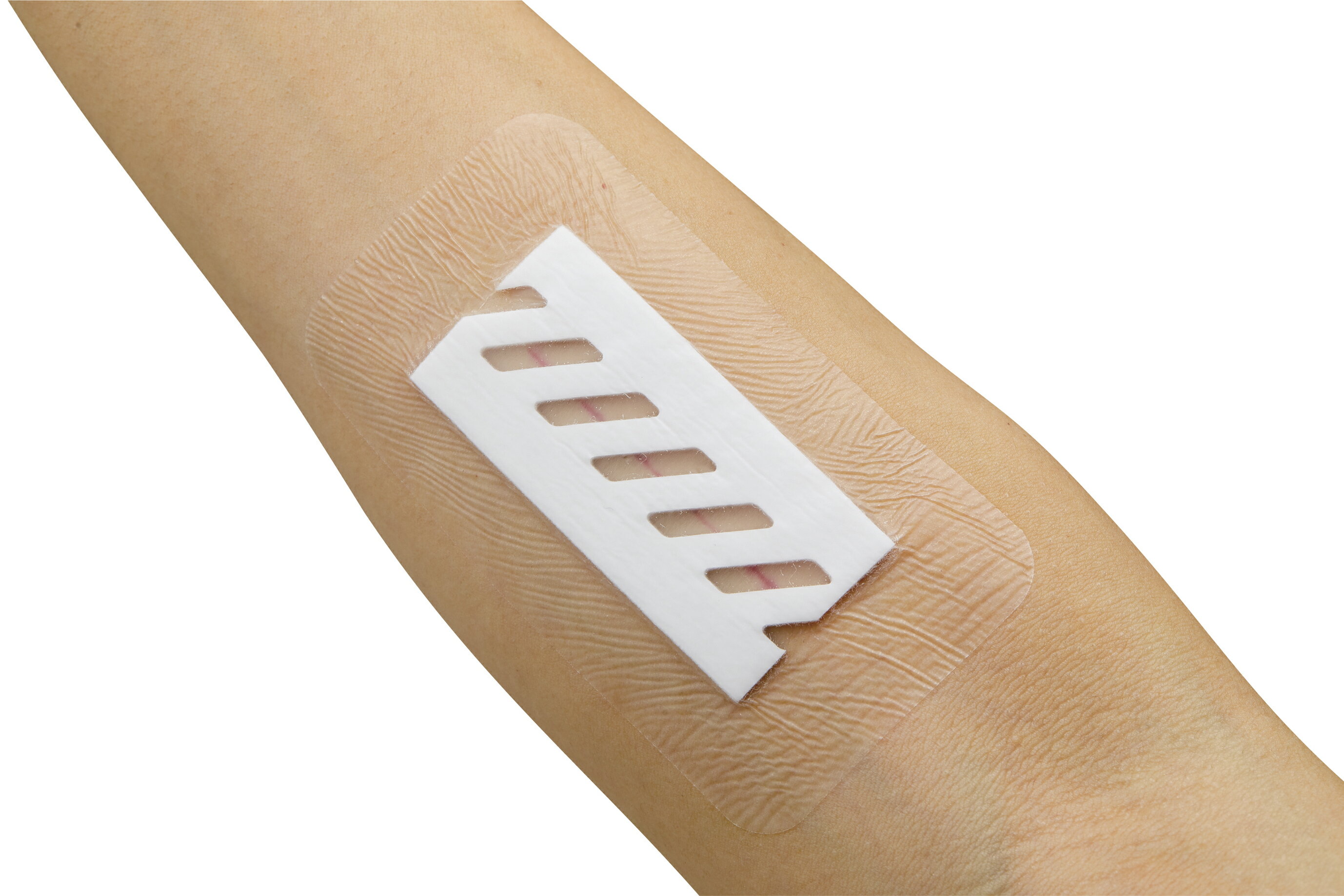 商品説明 ●縫合創用ドレッシング材。●超吸収性パッドはガーゼ10枚分以上の吸収力があり創部に血液や滲出液が溜まりにくい仕様です。●パッドに開孔部があり創部の観察が可能です。 商品スペック ●サイズ（粘着部/パッド部）：90×270mm／50...