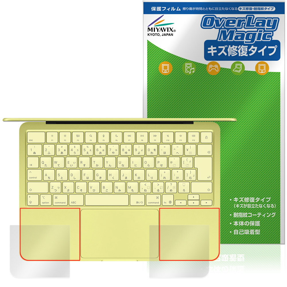 アップル「MacBook Neo A18 Pro (2026年3月発表モデル)」に対応したパームレスト用保護シート！ シート表面の擦り傷を修復する素材を使用した OverLay Magic(オーバーレイ マジック)！ パームレストの汚れやキ...