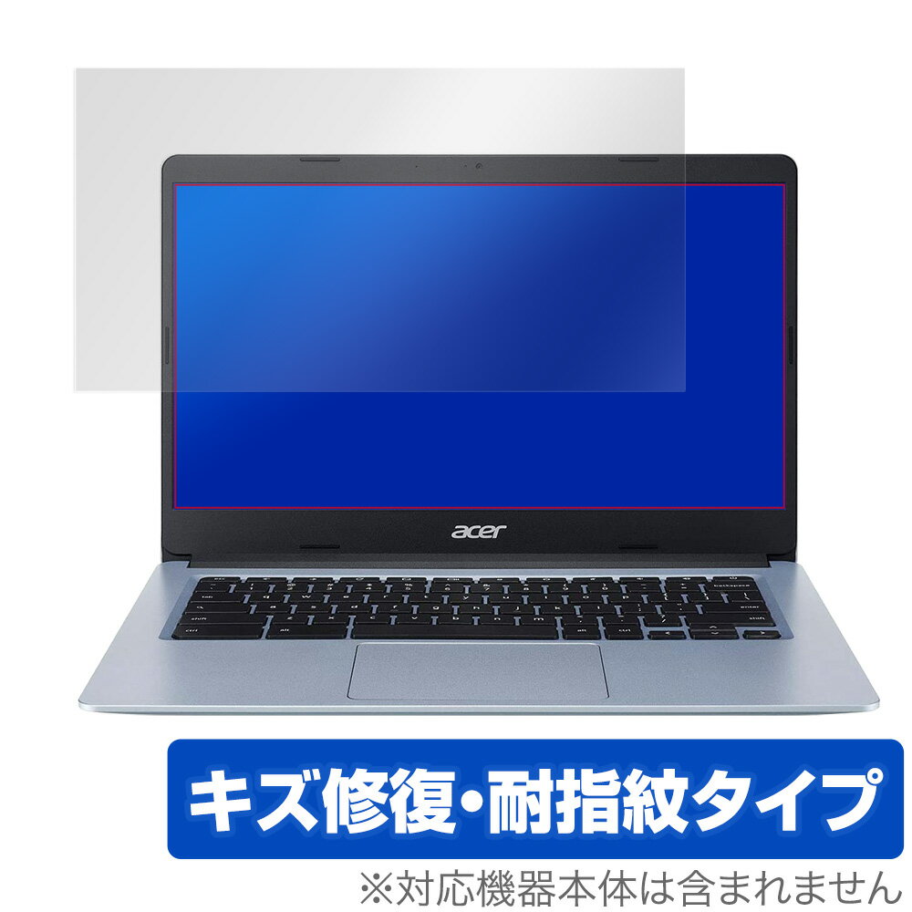 Acer「Chromebook 314 CB314-1HT」に対応したシート表面の擦り傷を修復する液晶保護シート！ キズ修復＆耐指紋タイプ OverLay Magic(オーバーレイ マジック)！ 液晶画面の汚れやキズ付き、ホコリからしっかり...