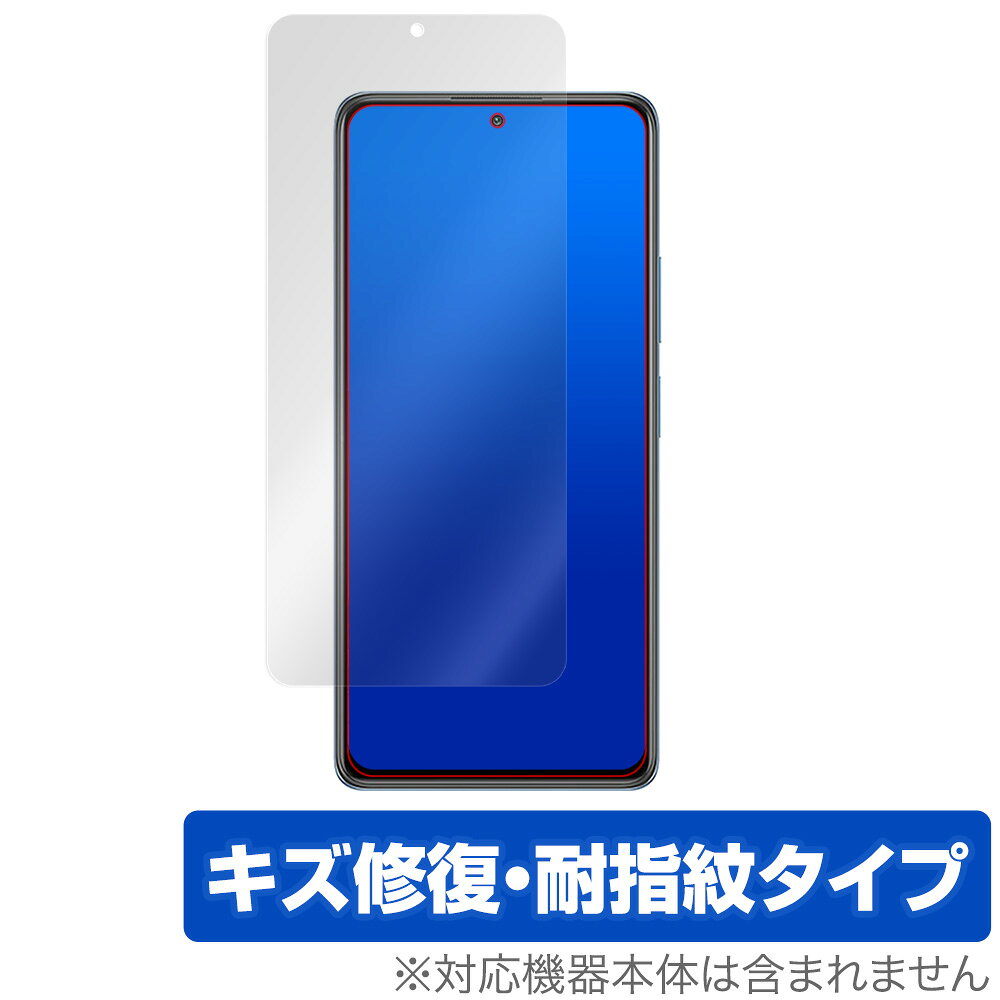 Xiaomi「Redmi Note 10 Pro」に対応したシート表面の擦り傷を修復する液晶保護シート！ キズ修復＆耐指紋タイプ OverLay Magic(オーバーレイ マジック)！ 液晶画面の汚れやキズ付き、ホコリからしっかり保護します...