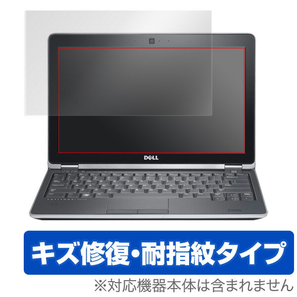 ■商品説明 Dell Latitude E6230 に対応したシート表面の擦り傷を修復するタイプの液晶保護シート OverLay Magic(オーバーレイ マジック)！液晶画面の汚れやキズ付き、ホコリからしっかり保護します。擦過により生じた...