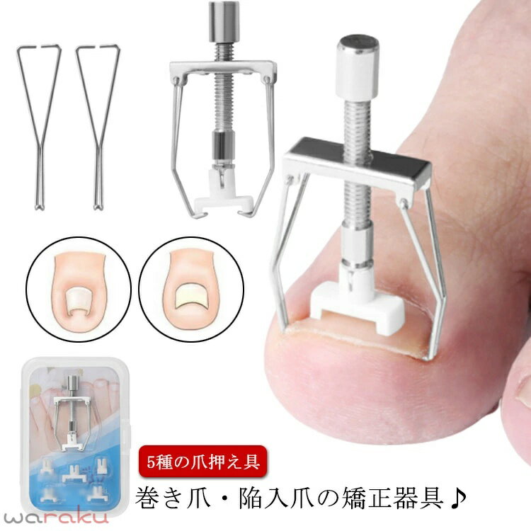 巻き爪・陥入爪の矯正器具・ ご自宅でセルフケアできるサポート器具、痛い巻き爪のお悩みを解消。 5種の爪押え具があり、足爪によってピッタリフィットできます。 高い矯正力を保ちつつ、繰り返し使えるからコスパよい巻き爪ケアセット。 サイズ F サ...
